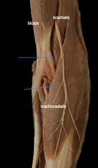 Lateral Antebrachial Cutaneous Nerve (LABCN) - Martinoli Ultrasound